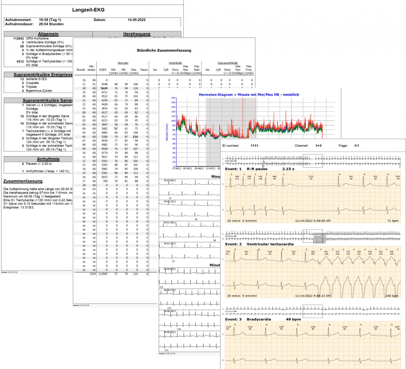 Cardiology - Medizin- und Informationstechnik AG