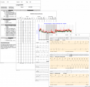 HeartX Holter - Medizin- und Informationstechnik AG